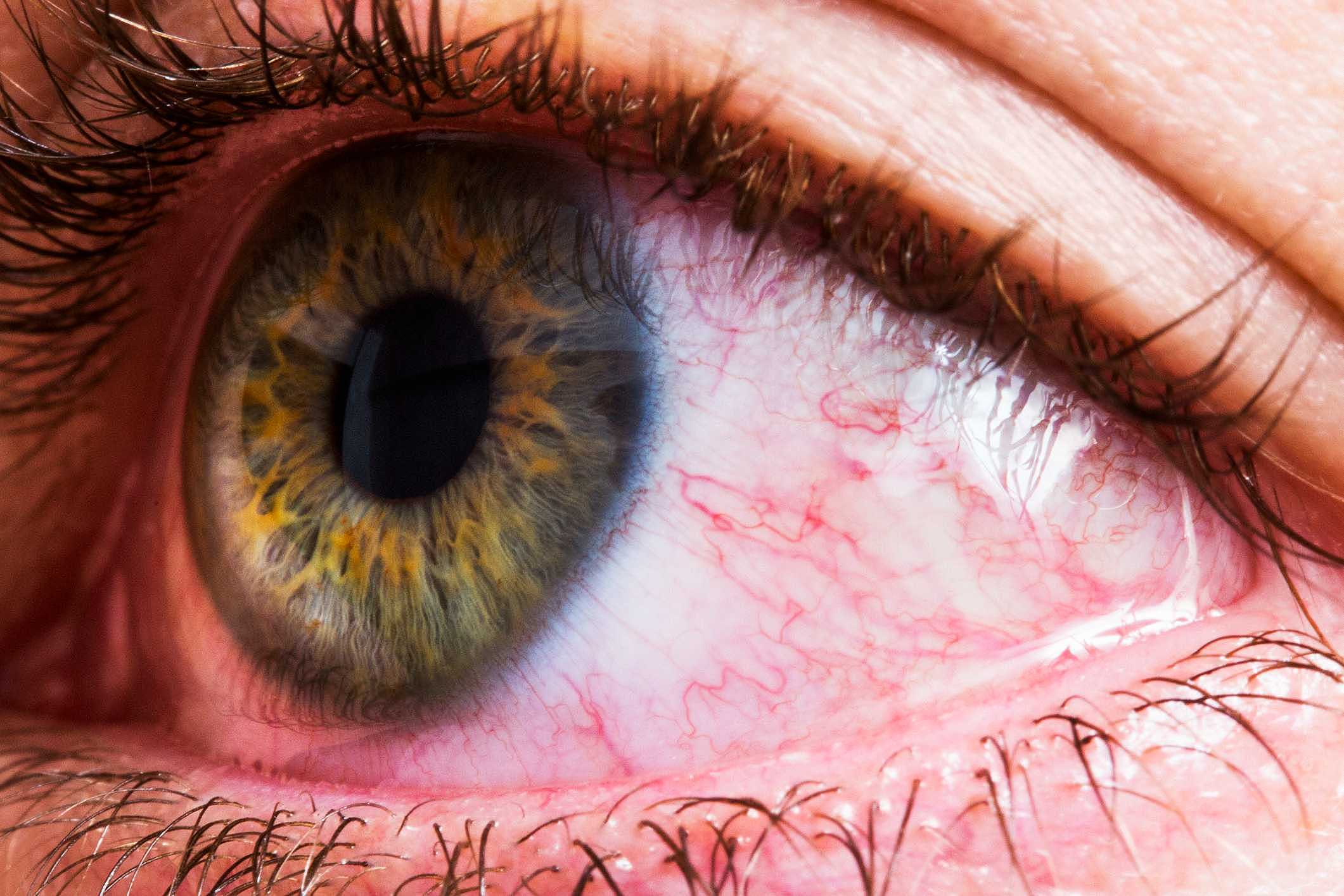 O que são traumas oculares? Descubra! - Olhar Certo Clínicas Oftalmológicas